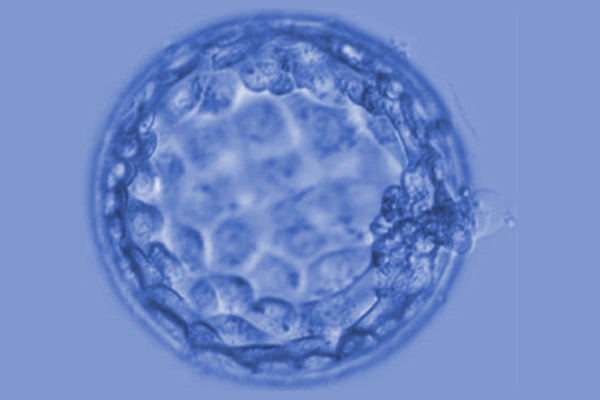 Study Reveals Public Opinion on Polygenic Embryo Screening for IVF ...