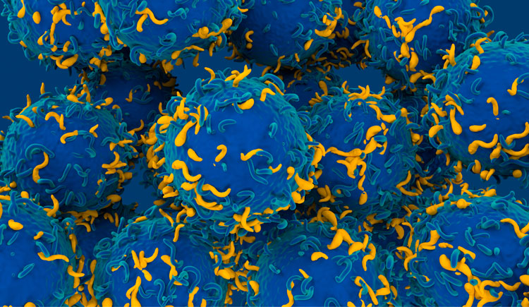 New Strategy for Preventing Relapse After CAR T-Cell Therapy | Harvard ...