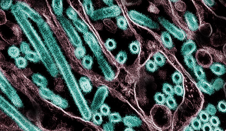 Are We on the Cusp of a Major Bird Flu Outbreak? | Harvard Medical School