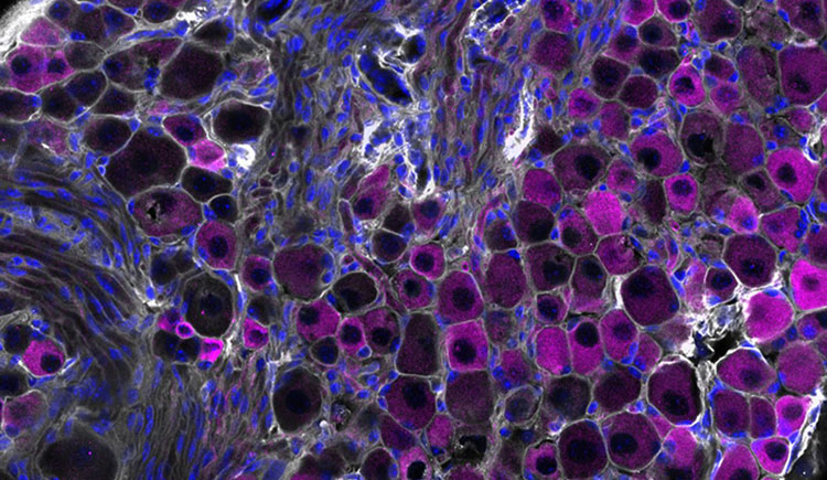 Unusual Allies: Vagus Nerve Cells Emerge as Defenders Against Flu ...