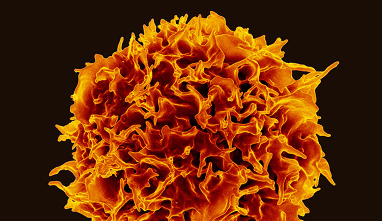 Research Identifies New Ways To Supercharge Cancer Immunotherapy ...