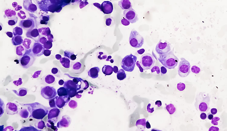 Exploring CRISPR Technology To Enhance Cancer Immunotherapy | Harvard ...