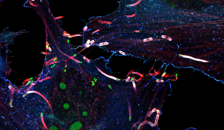 What We Need To Know To Stop a Listeria Outbreak | Harvard Medical School