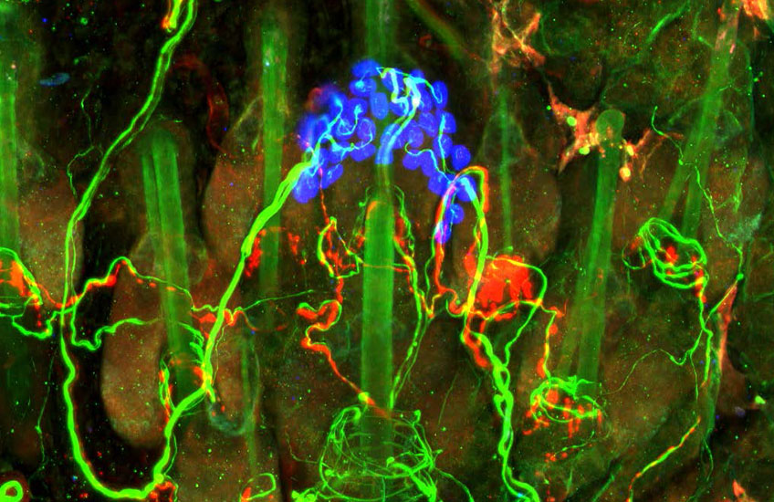 Harvard Medical School Scientist Wins Top Neuroscience Prize | Harvard ...