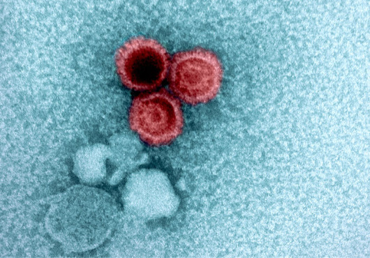 Are We on the Cusp of a Major Bird Flu Outbreak? | Harvard Medical School