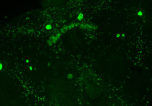 Creating the Next Generation of mRNA Vaccines | Harvard Medical School