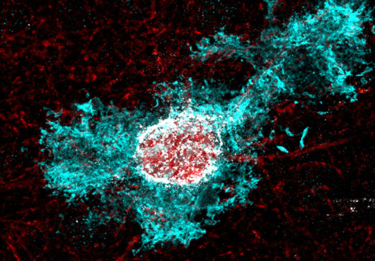 Exercise Hormone Protects Neurons in Preclinical Model of Multiple ...