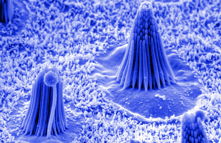 Hearing Research Traces Evolution of Key Inner-Ear Protein | Harvard ...