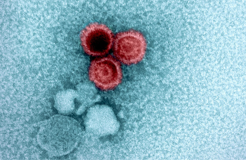 New Insights Into Long-Term Effects of Common Viruses | Harvard Medical ...