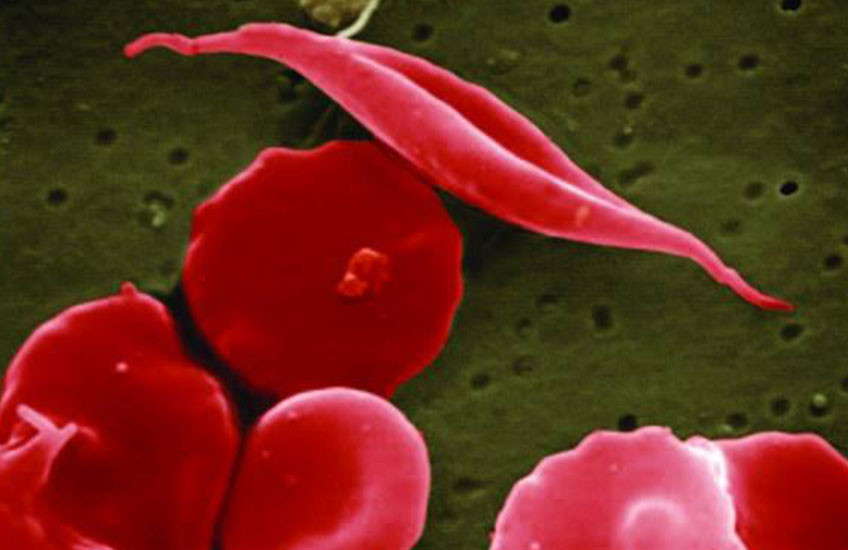 2026 Warren Alpert Foundation Prize Awarded for Gene-Editing Therapies ...