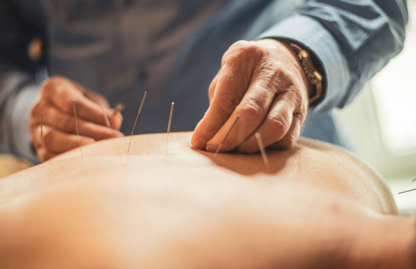 acupuncture for backache