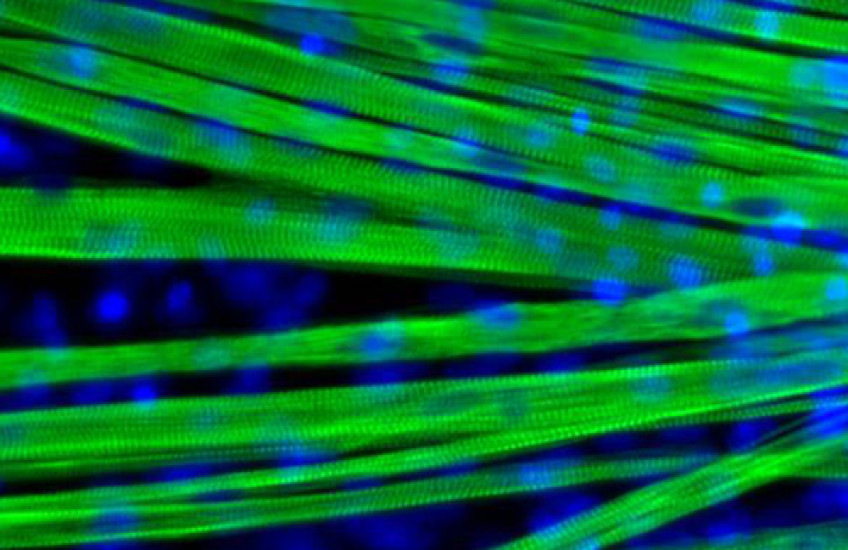 Building Muscle | Harvard Medical School