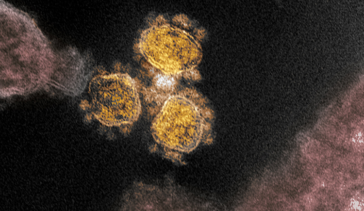 Infection Detection | Harvard Medical School