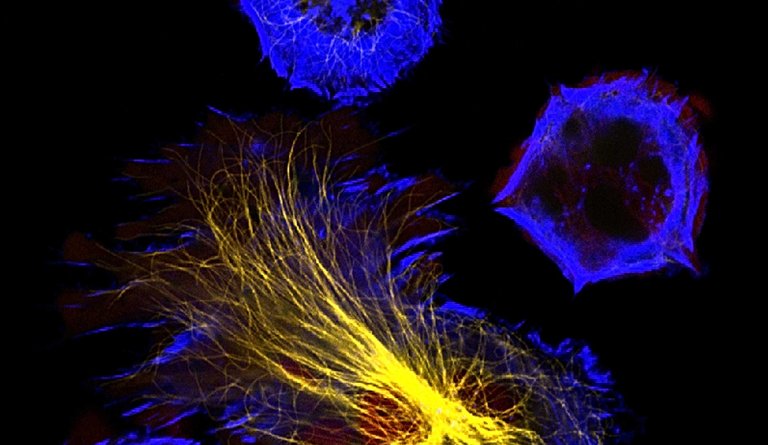 Major Grant for Study of Cell Fate in Cancer | Harvard Medical School