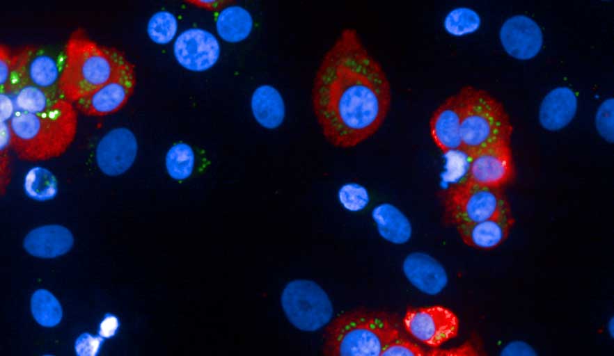 Deleting Old Cells | Harvard Medical School