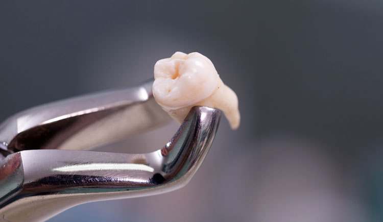 Predicting Tooth Loss | Harvard Medical School