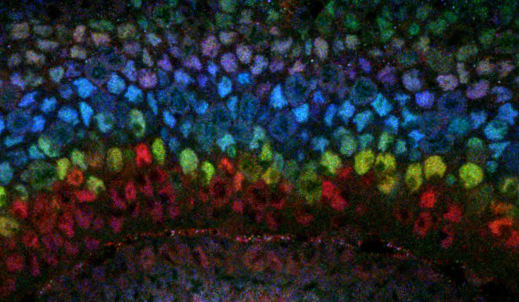 Seeing Cells | Harvard Medical School