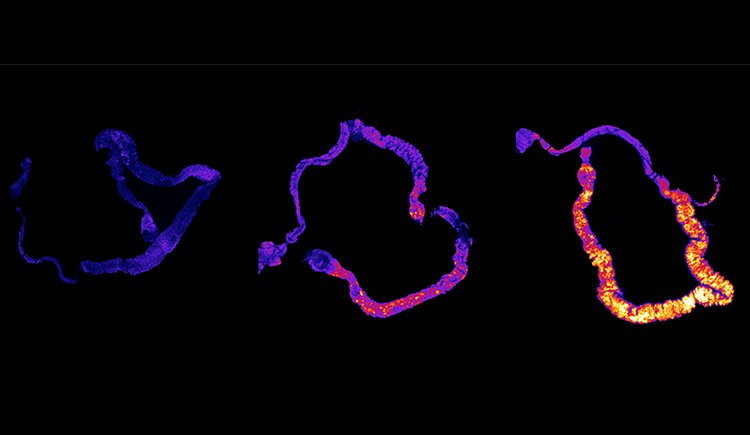 Sleep, Death and … the Gut? | Harvard Medical School