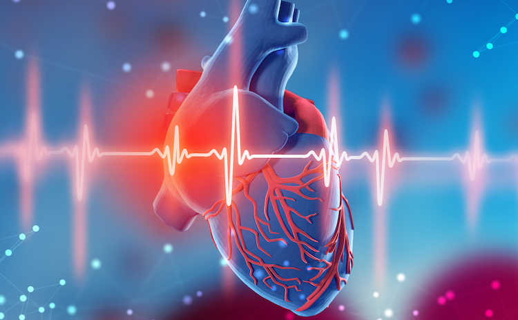 Heart Trouble | Harvard Medical School