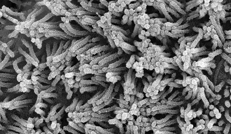 Intestinal Insight | Harvard Medical School