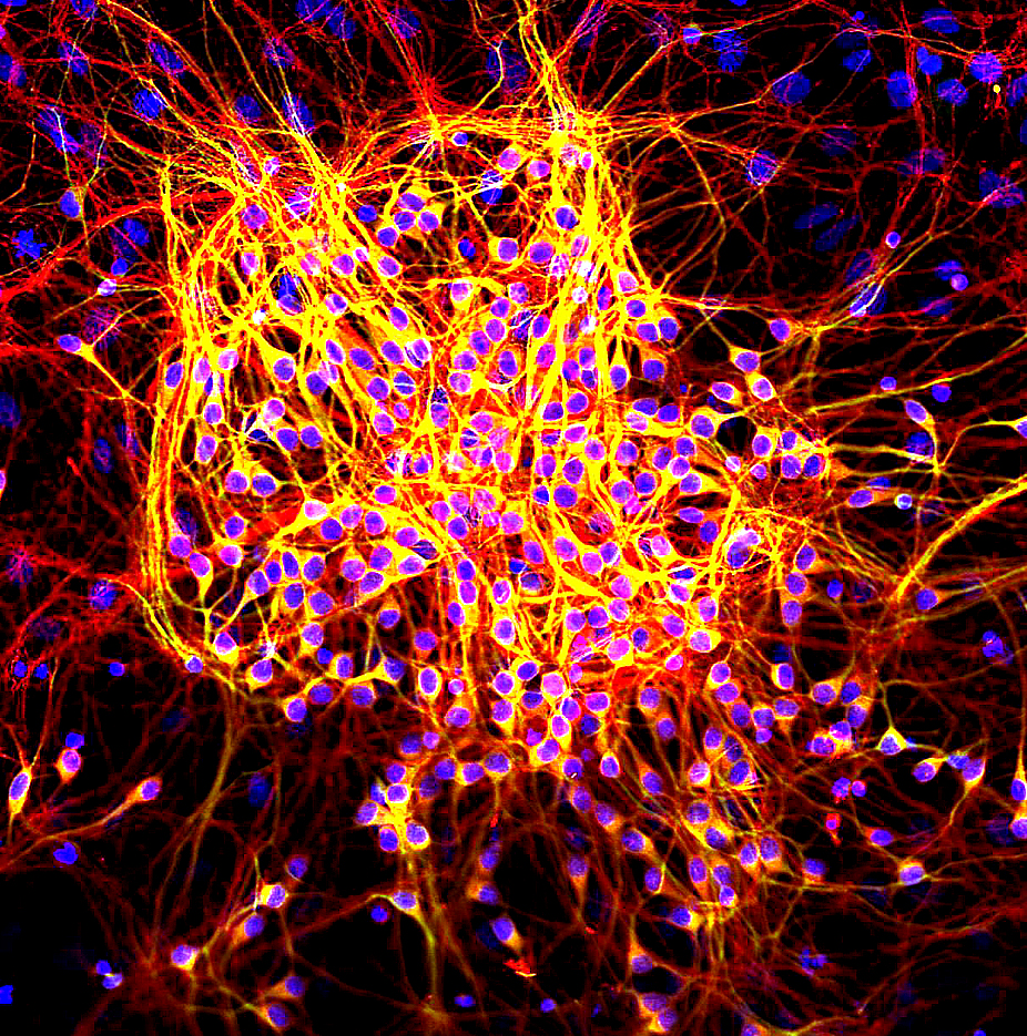 Neural Disruption | Harvard Medical School