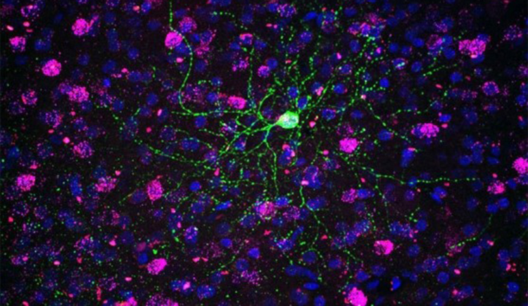 New Interneuron | Harvard Medical School