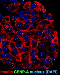 Helping Beta Cells Divide to Conquer | Harvard Medical School