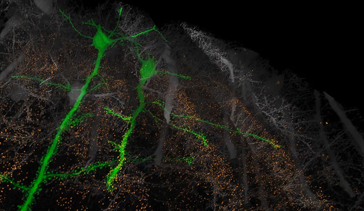 Brain Expansion | Harvard Medical School