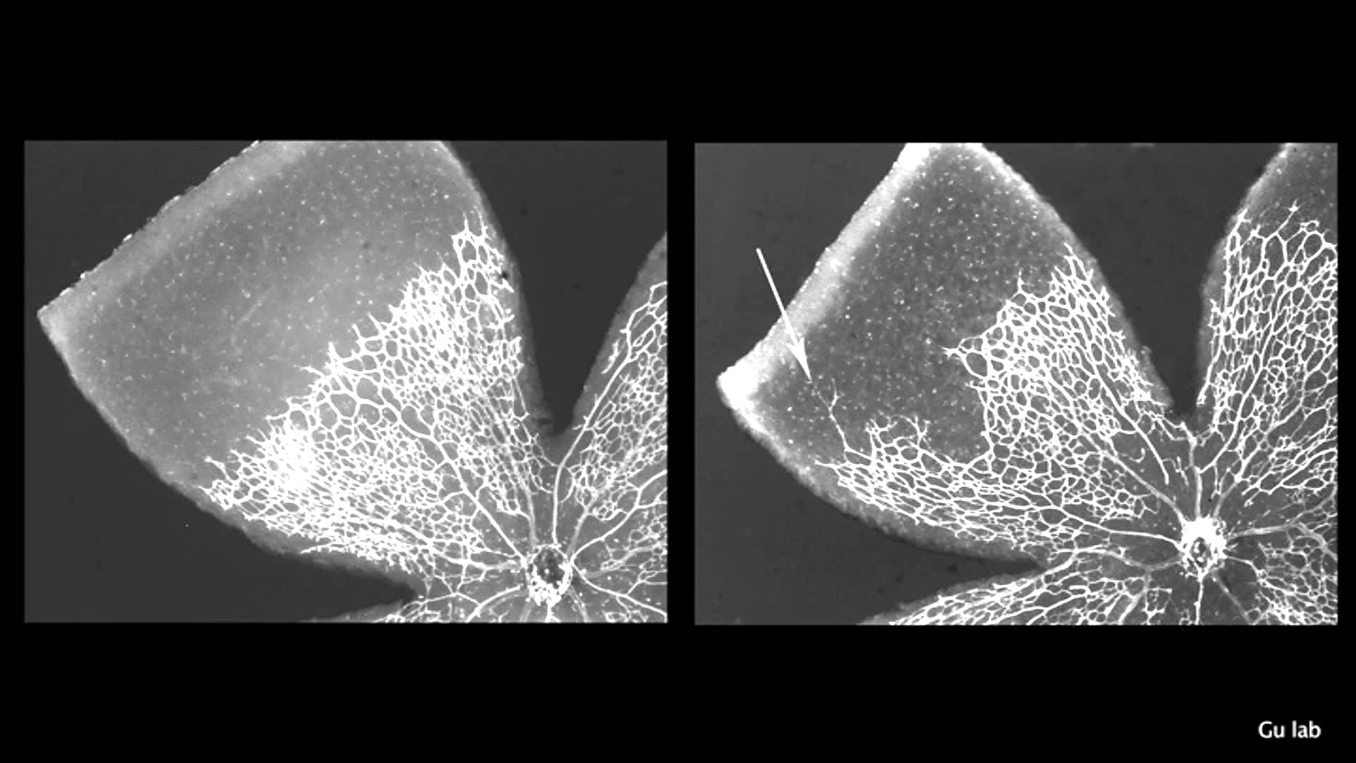 Building Blood Vessels | Harvard Medical School