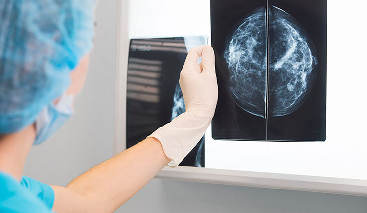 How Breast Cancer Arises | Harvard Medical School