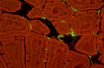 Our Microbes, Ourselves | Harvard Medical School