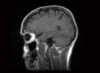 Inside the Brain’s Black Box | Harvard Medical School