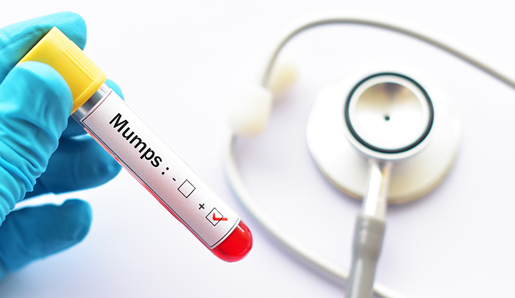 Profiling mumps' behavior | Harvard Medical School