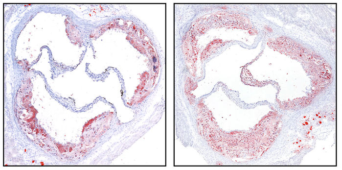 Taking Sleep to Heart | Harvard Medical School