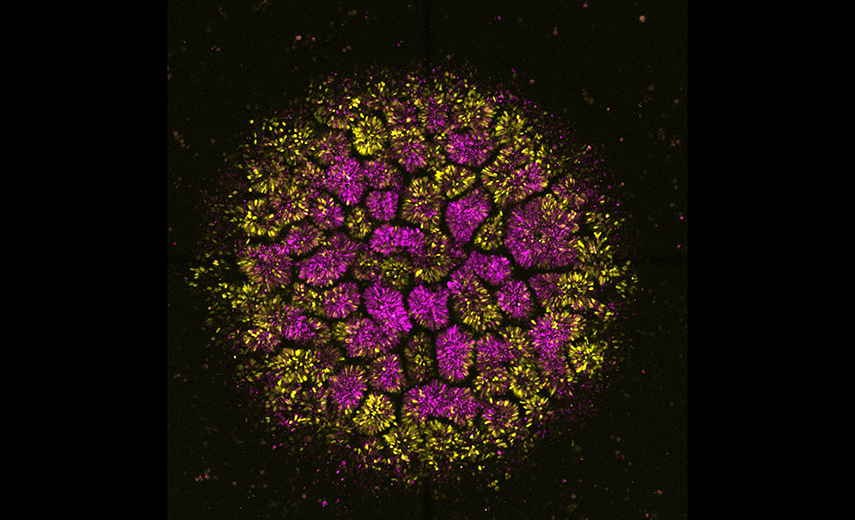 A 3D Model for Studying Human Spine Development | Harvard Medical School